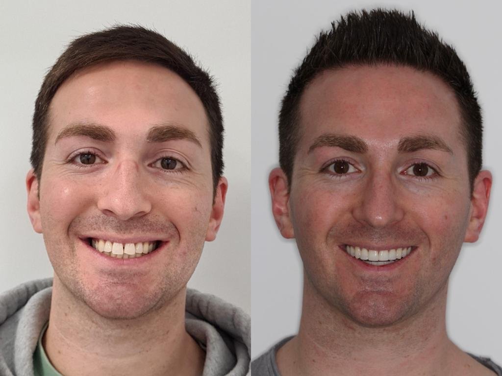 Patient Gallery - gedling-dental.co.uk