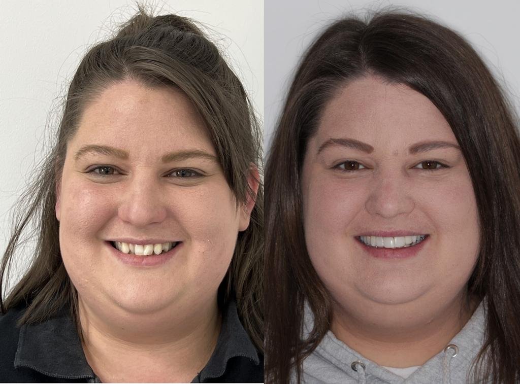 Patient Gallery - gedling-dental.co.uk